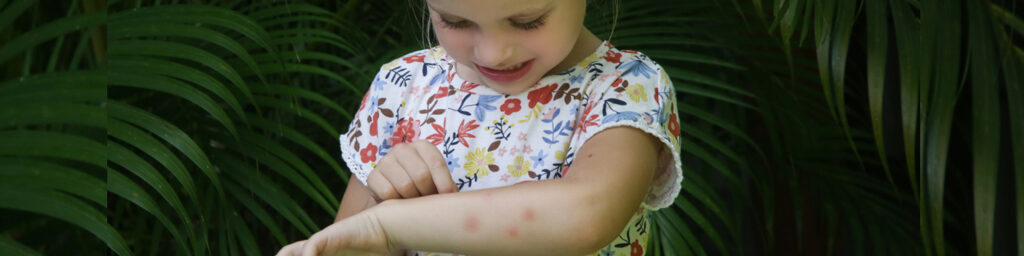 Itchy bumps on skin like mosquito bites but aren’t - Mosquito Sheriff